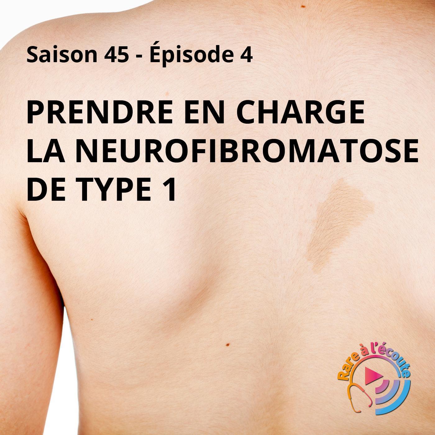 Maladie rare - Prendre en charge la Neurofibromatose de type 1 ...